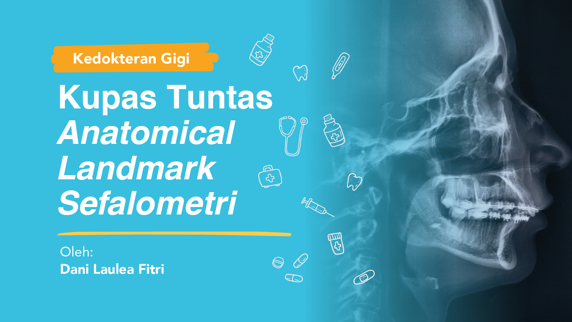 Kupas Tuntas Anatomical Landmark Sefalometri